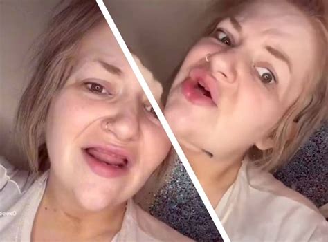 From A Toothless Woman To A Party Queen Photos Of An Incredible