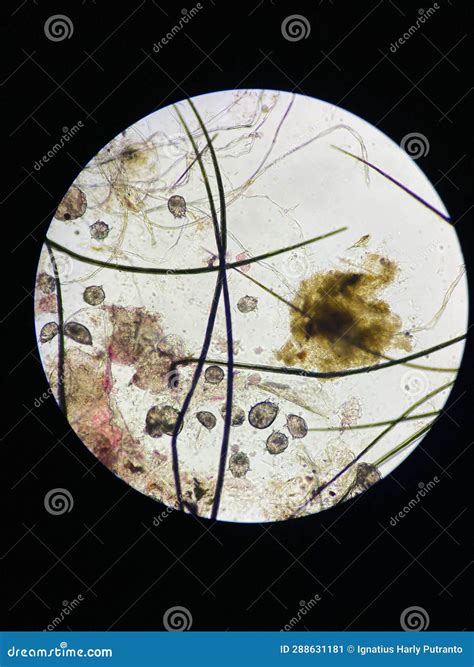 Notoedres Cati Under The Microscope Notoedric Mange Also Referred To