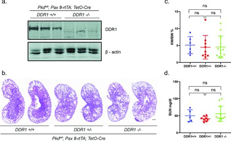 Genetic Deletion Of Ddr1 Does Not Slow Cyst Growth Of Preserve Renal
