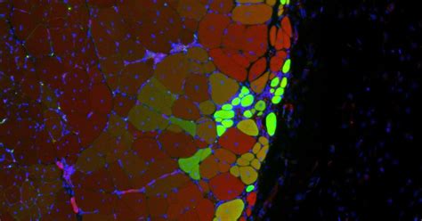 Stem Cell Loaded Hydrogel Boosts Healing Process Of Aging Muscles