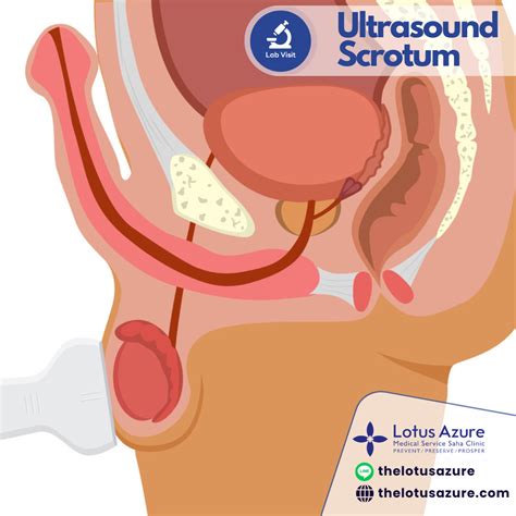 Ultrasound Scrotum Lotus Azure