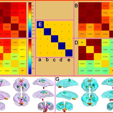Exhibiting Abnormal Degree Centrality In Patients With Stbi Download Scientific Diagram