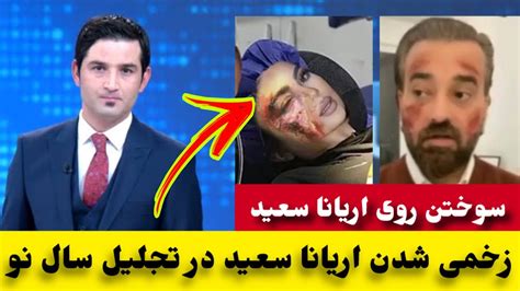 دلیل زخمی شدن اریانا سعید چیست و گریه حسیب سایدaryana Sayeed Hasib