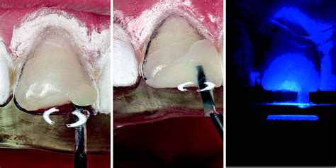 Flowable Resin At Skye Milliner Blog