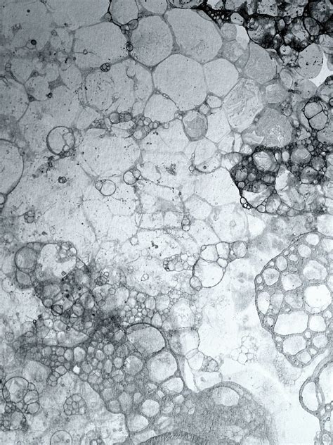 Back Propagation Algorithm Numerical Solved By Sujan Karna Medium