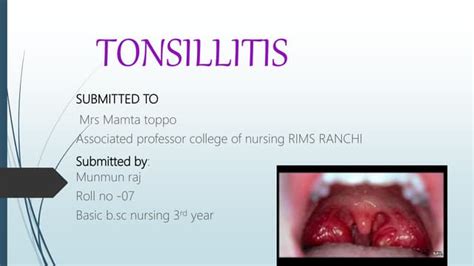 Nursing Management Of The Patient With Tonsillitis Ppt Pptx