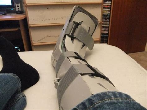 Plaster Cast Versus Functional Brace For Non Surgical Treatment Of Achilles Tendon Rupture