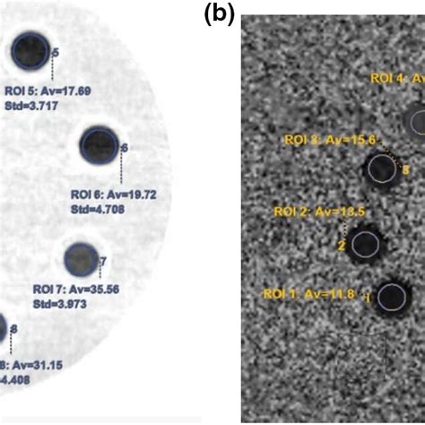 The Exact Values In Nine Roi Tubes By Ct And Mr Fat Fraction Images Download Scientific