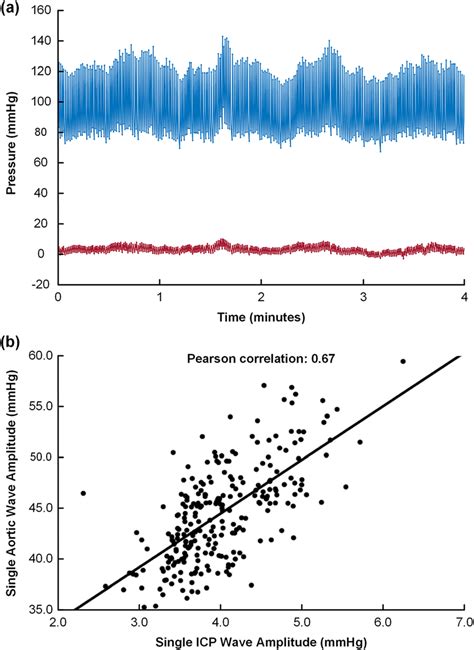 The Intracranial Aortic Amplitude Correlation A Simultaneous Central