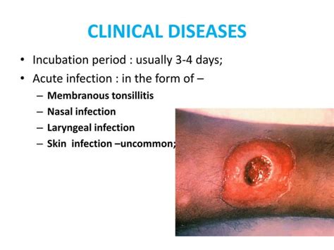 Corynebacterium Pptx