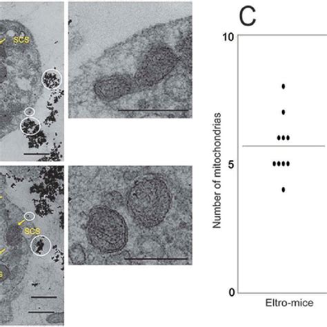 Sem Observation Of Human Cd41 Positive Platelets Human Cd41 Positive