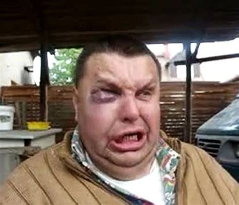 Napad Na Kononowicza 2015 [kononopedia]