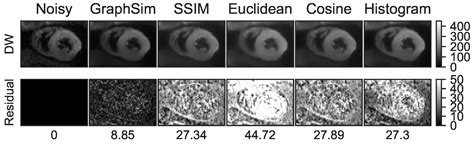 Node2node Self Supervised Cardiac Diffusion Tensor Image Denoising Method