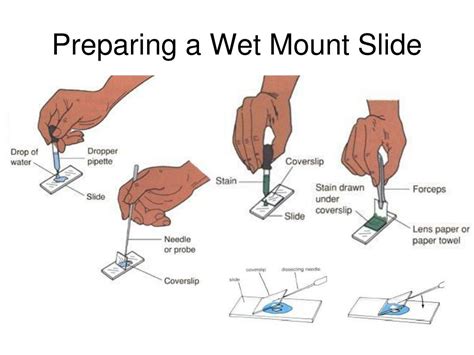 Wet Mount Definition Wet Mount Definition And Meaning Xbvya