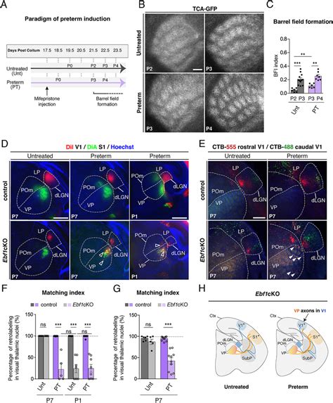 Preterm Birth Affects The Efficiency Of Tca Rewiring A Experimental