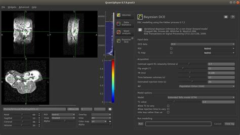 dce mri data analysis tutorial — quantiphyse documentation
