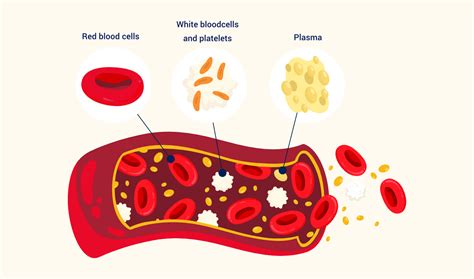 Thrombocytopenia Ayurvedic Treatment Itp Disease Treatment