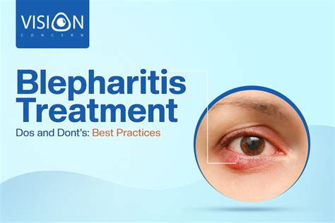 Blepharitis Treatment Guide Say Goodbye To Irritated Eyes