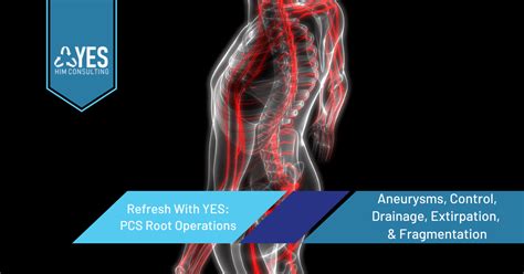 Icd 10 Pcs Root Operations Aortic Aneurysms And Drainage