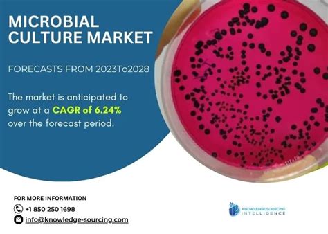 Microbial Culture Market Size And Share Industry Report 2023 2028