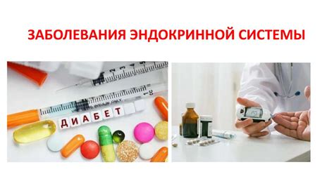 Заболевания эндокринной системы презентация онлайн