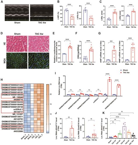 Long Noncoding Rna Ak144717 Exacerbates Pathological Cardiac