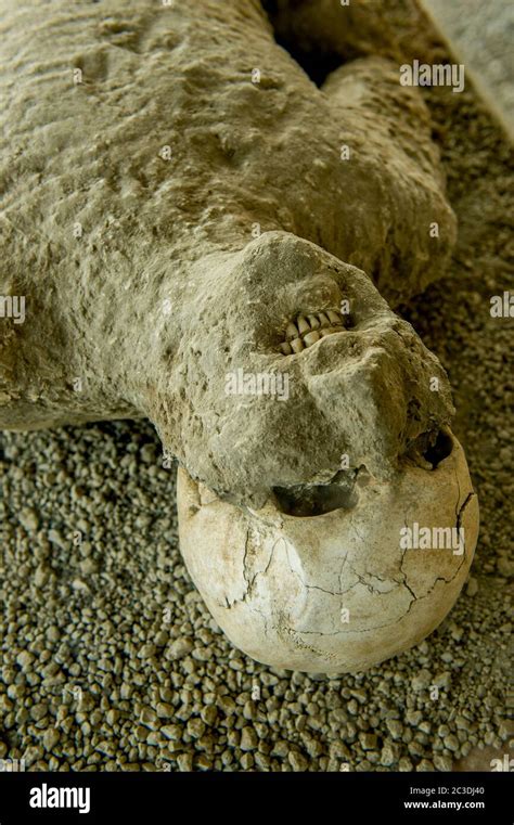 Plaster Cast Of A Victim Of The Volcanic Eruption In Pompeii Near