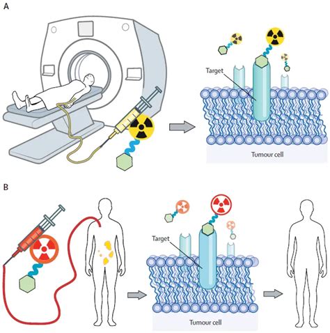 核药到底火在哪里？治疗类rdc会是核药领域新的爆点吗？ 财富号 东方财富网