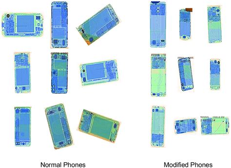Samples Of Mpxray Including Normal Phonesnegative And Modified