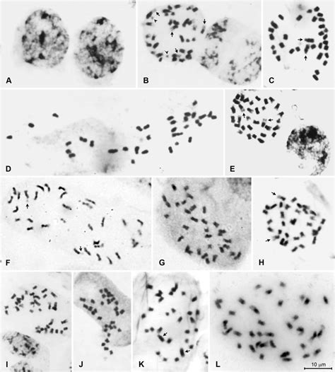 Standard Staining Of Interphase Nuclei And Mitotic Chromosomes Of Download Scientific Diagram