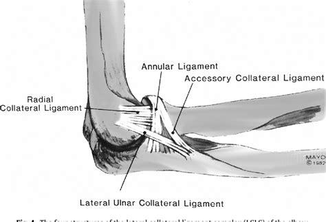 Avulsion Fracture Of The Supinator Crest As An Indication For A Sustained Posterolateral Sub