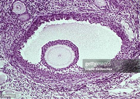 Antrum Photos And Premium High Res Pictures Getty Images