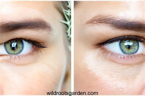 11 More Benefits Of Aloe Vera Under Eyes Before And After