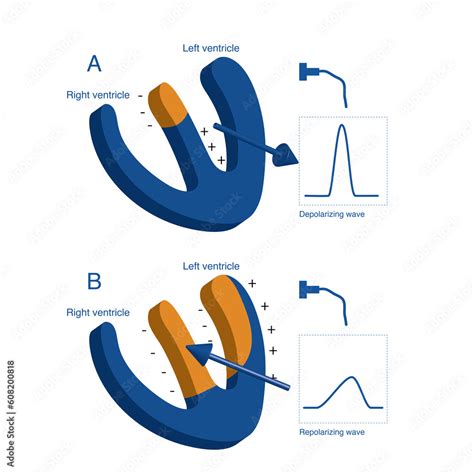 The Normal Ventricular Depolarization Starts From The Left