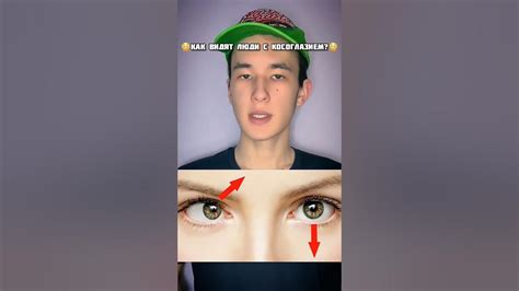 👀КАК ВИДЯТ ЛЮДИ С КОСОГЛАЗИЕМ⁉️😳 Shorts глаза Youtube