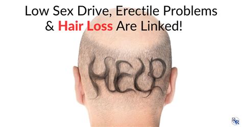 👨‍🦲low Sex Drive Erectile Problems And Hair Loss Are Linked