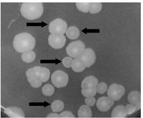 High Temperature Resistant Polyhydroxybutyrate Generating Bacterium Eureka Patsnap