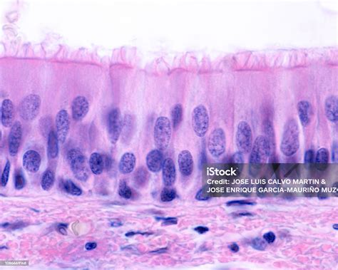 Pseudostratified Columnar