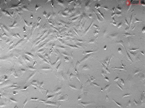 Human Choroid Plexus Epithelial Cells HCPEpiC