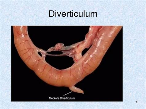 Liver Abscess Ppt