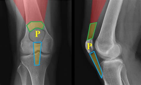 Patella Bone