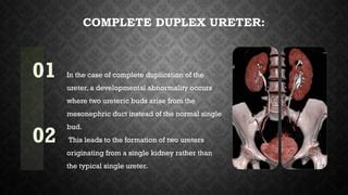 Duplex Renal Systemcompletepartial Duplex Renal System Pptx