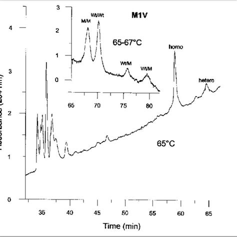 Cze Analysis Of Mutant M1v In Exon 1 Of The Cftr Gene The Panel Shows Download Scientific