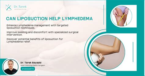 What Is Lipo Lymphedema Causes And Treatment 2025
