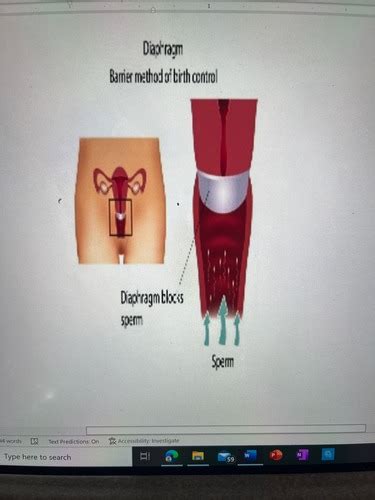 Contraception Flashcards Quizlet