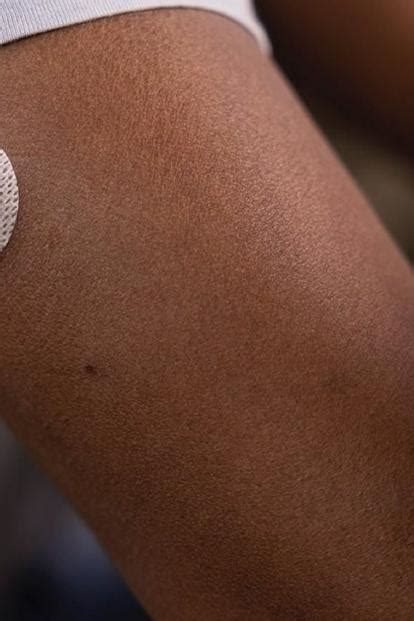 제 1형 당뇨 제 2형 당뇨 임신성 당뇨를 위한 덱스콤 G7 연속혈당측정기 Dexcom