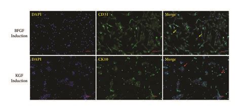 Immunofluorescence Staining Of Dapi Blue And Cd31 Ck10 Green In