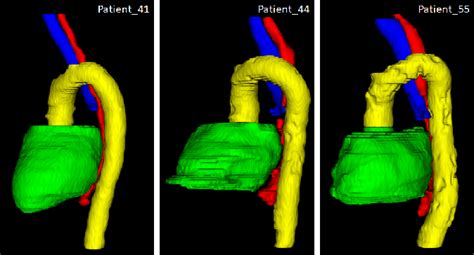 Figure 3 From A 2D Dilated Residual U Net For Multi Organ Segmentation In Thoracic CT Semantic