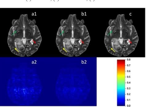 Figure 1 From A 3d Multi Modal Network For Mri Fast Reconstruction Semantic Scholar