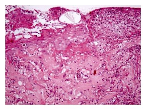Histological Analysis A Switching Between Skin Covered By Skin And Download Scientific
